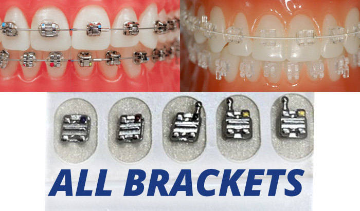 Orthodontic Supplies - Orthodontic tools | Modern Arches Quality