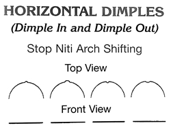 Natural, European and Universal Orthodontic Arch Forms