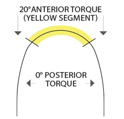 NiTi-Pre-Torqued Arch Wires